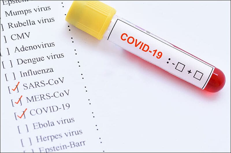 Pressemitteilung der DGKL – Aufbau von zentralisierten Teststellen ...